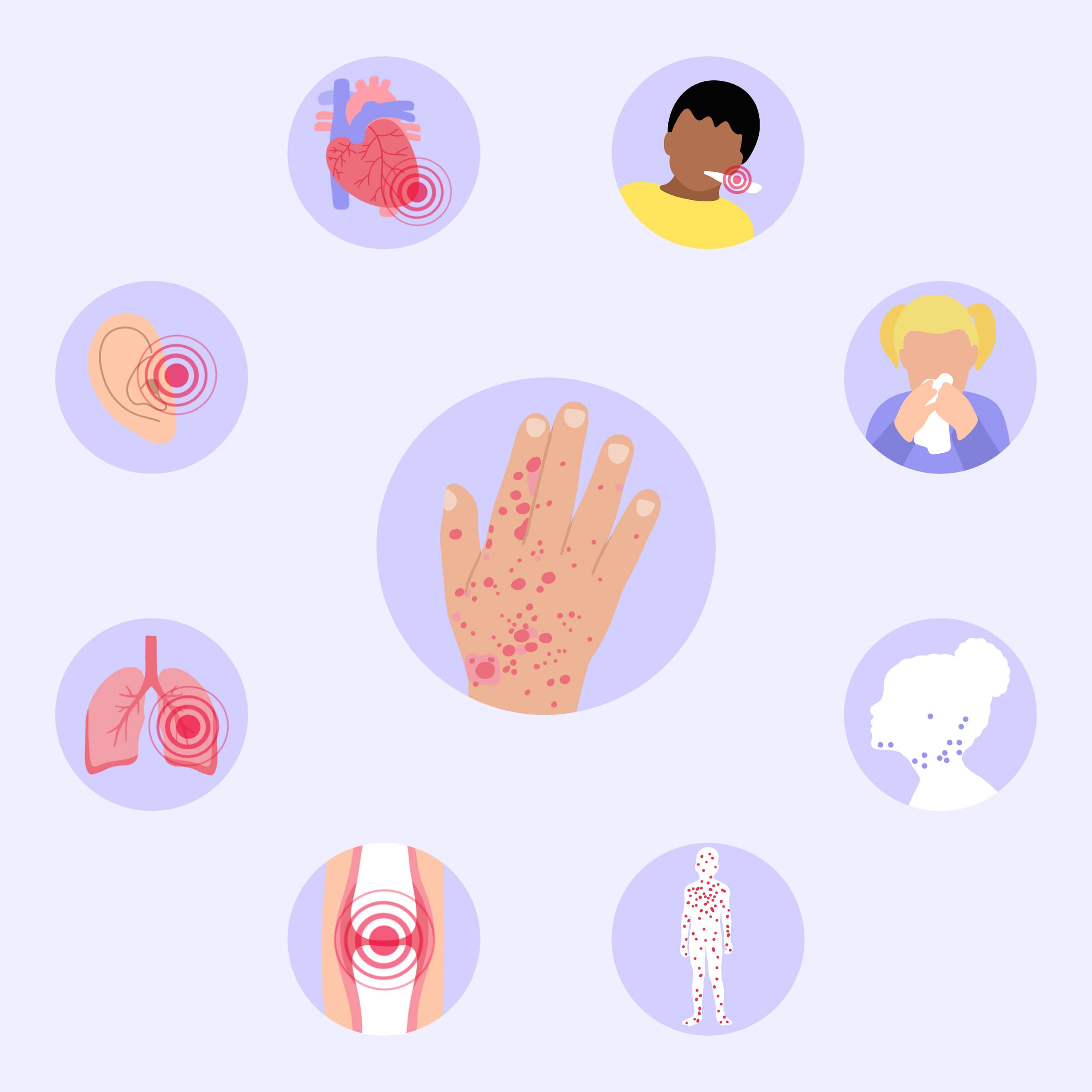 Röteln - Symptome & Ansteckung | Shop Apotheke